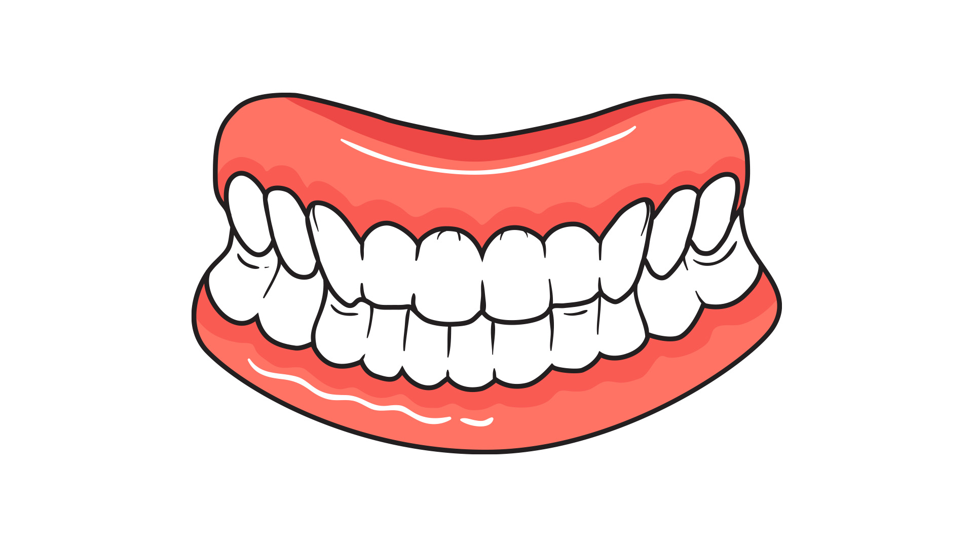 Effects of Missing Teeth | Emerald Dental Clinic Nairobi