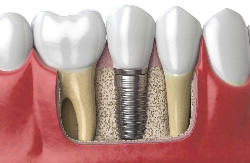 Emerald Dental Clinic | Best Dental Clinic in Nairobi